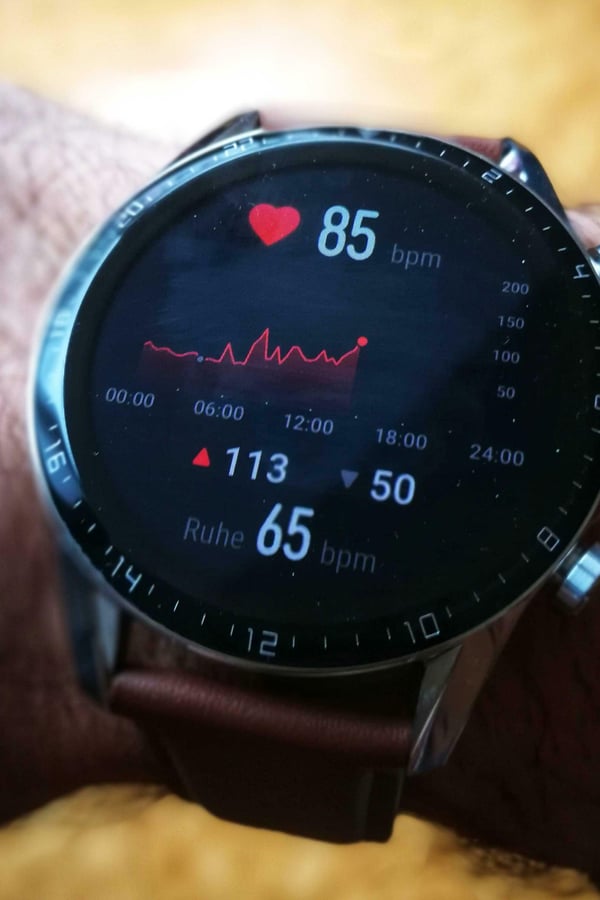 Ausdauersportler Amazfit GTS und Huawei GT2 im Test