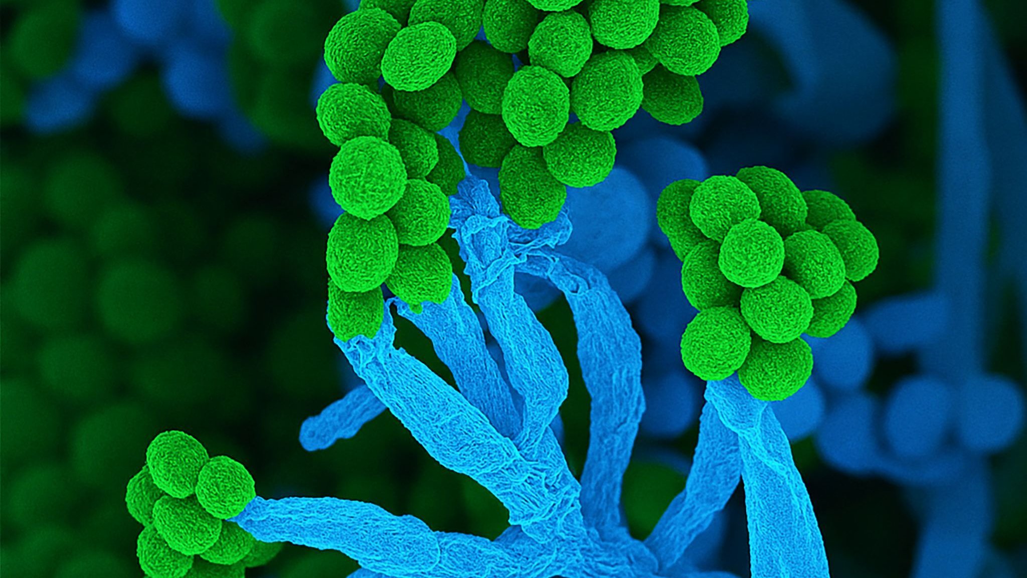 Penicillin: Zig Millionen Leben gerettet – ein Schimmelpilz ist die ...